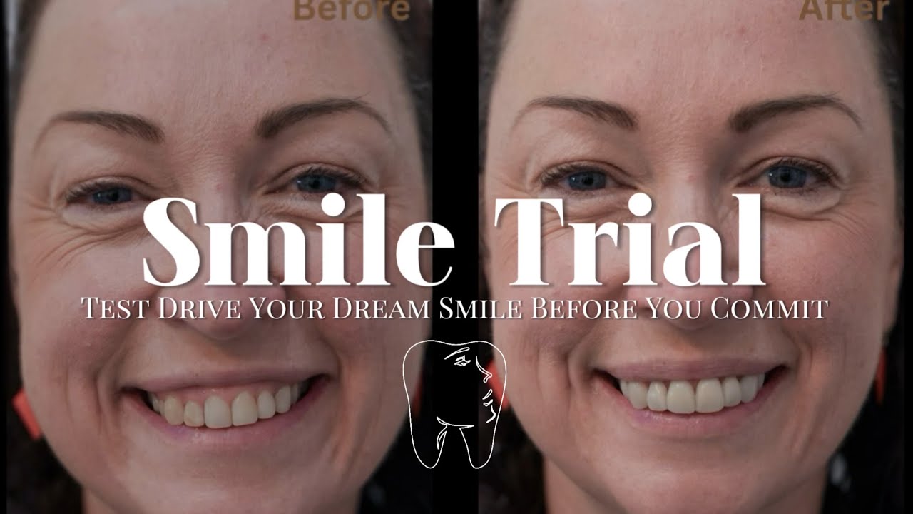 Smile Trial: What Is It & Why It Matters - YouTube