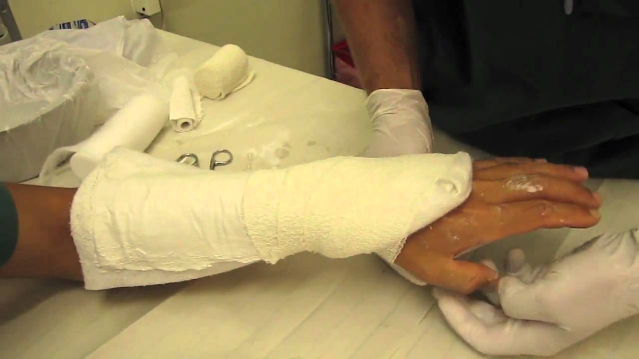 Radiusskena - YouTube