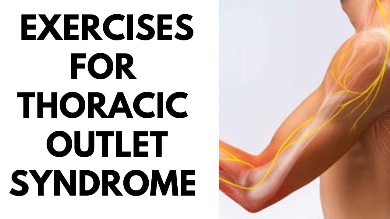 Thoracic outlet syndrome exercises|thoracic outlet syndrome treatment ...