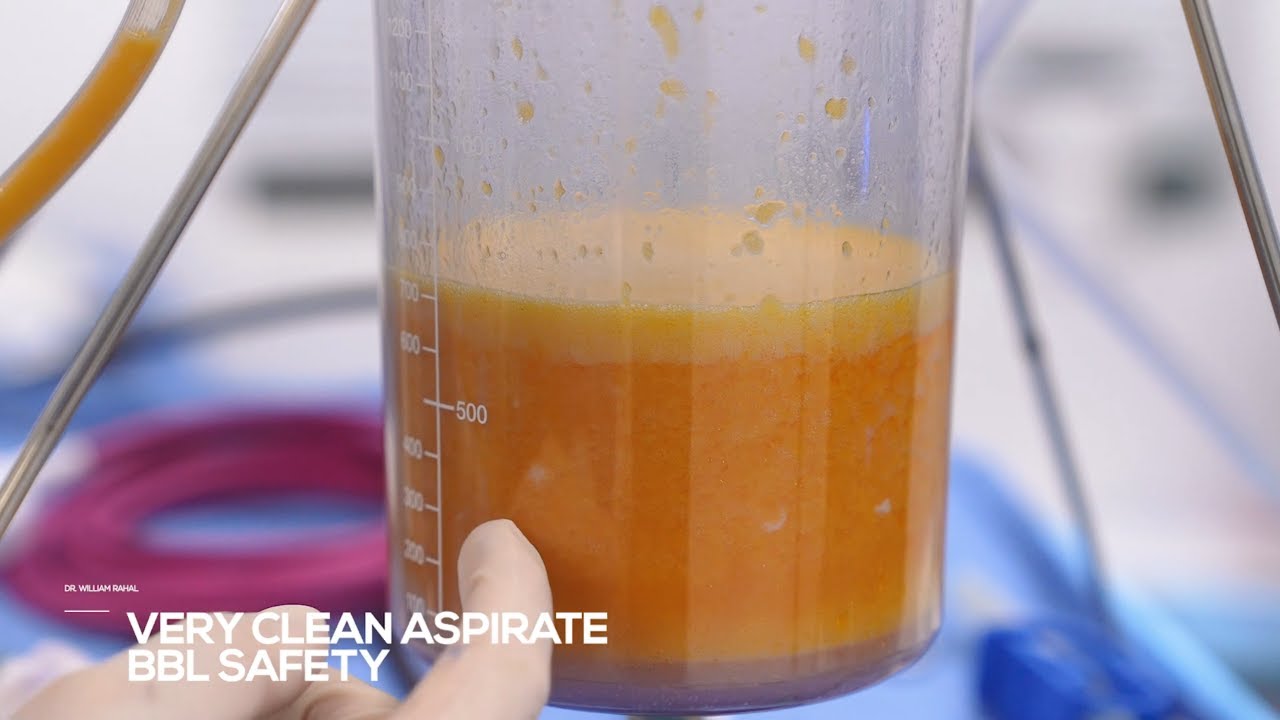 What is BBL Safety and why is it so important? Dr. Rahal Discusses ...