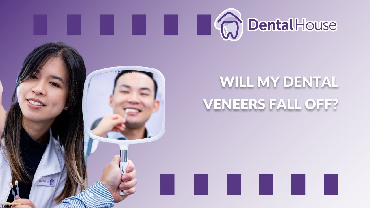 Will My Dental Veneers Fall Off? - YouTube