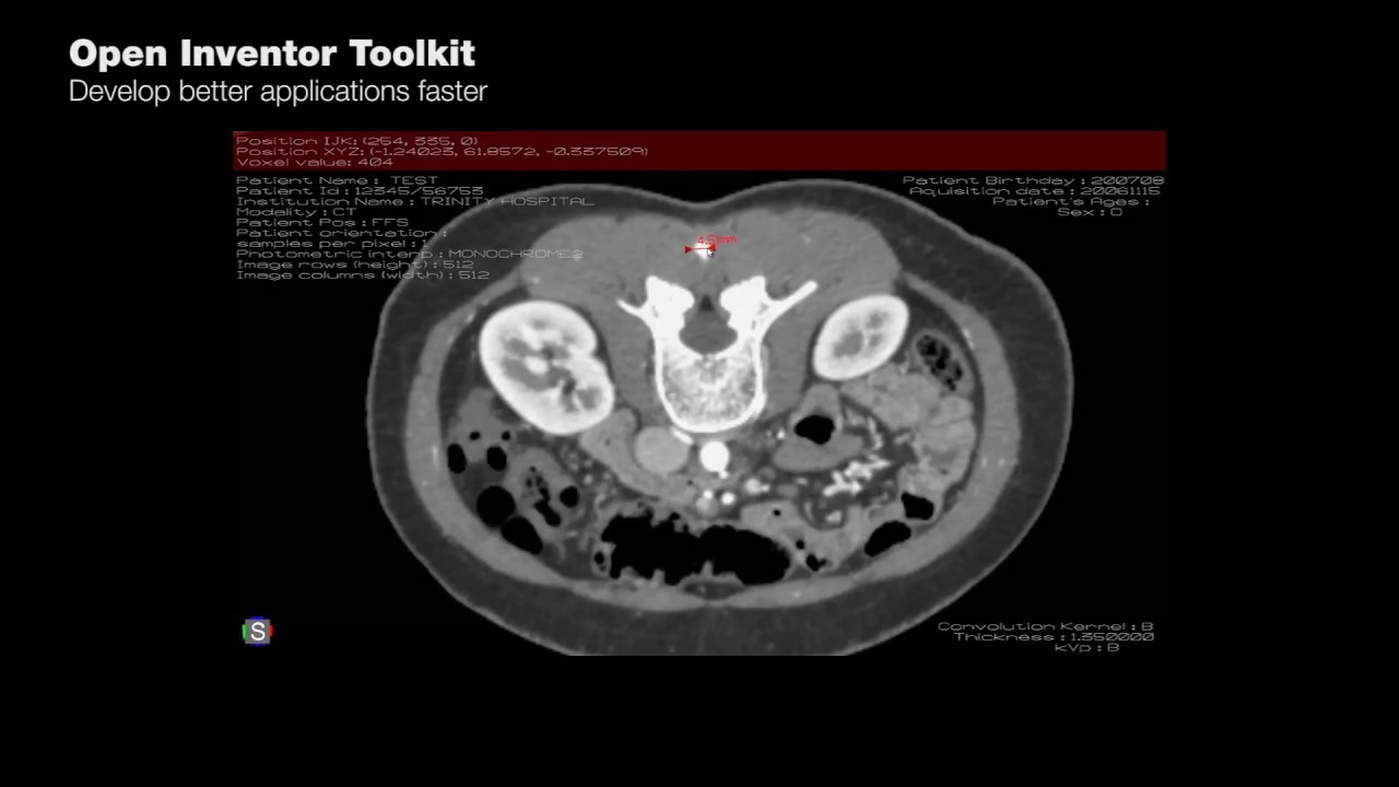 Open Inventor Toolkit | Measurement on Dicom dataset | 3D Visualization ...