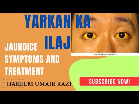 yarkan ka ilaj peela yarkan jaundice symptoms causes treatment # ...