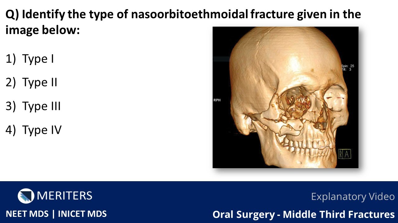 NEET MDS | INICET - Oral Surgery - Middle Third Fractures | Explanatory ...