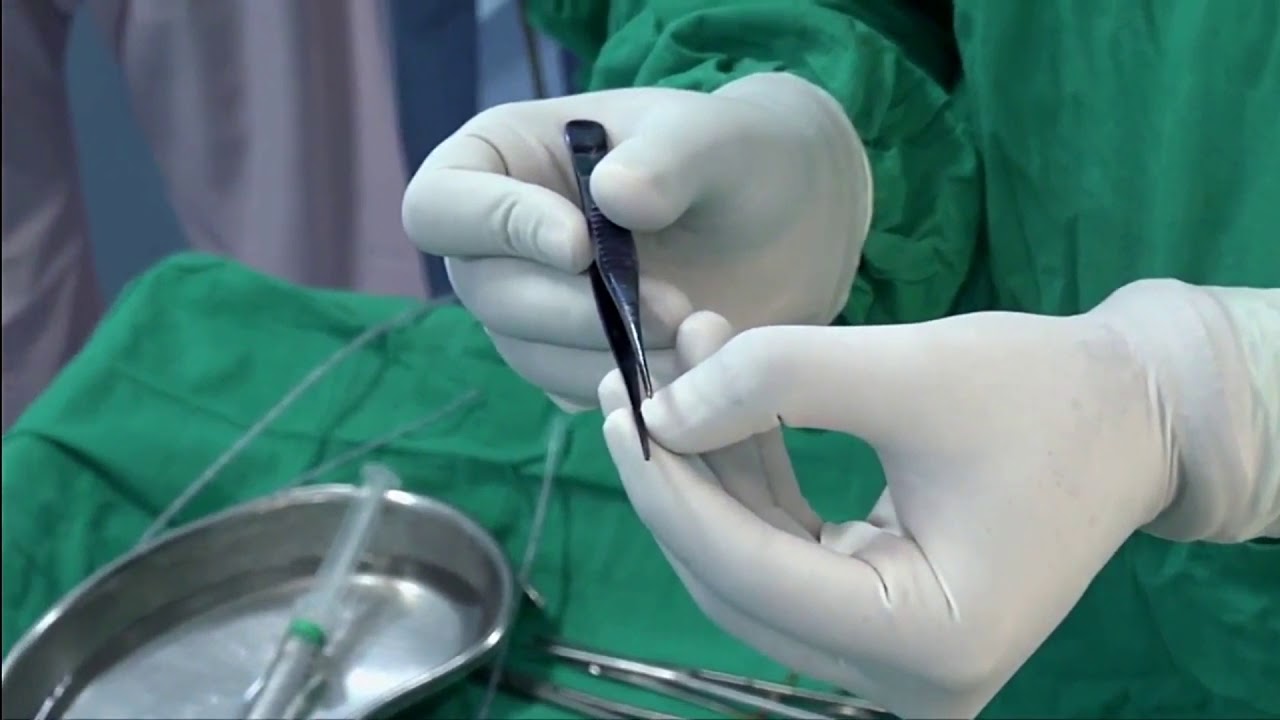 Instruments for AV Fistula- From the table of Dr Himanshu Verma - YouTube