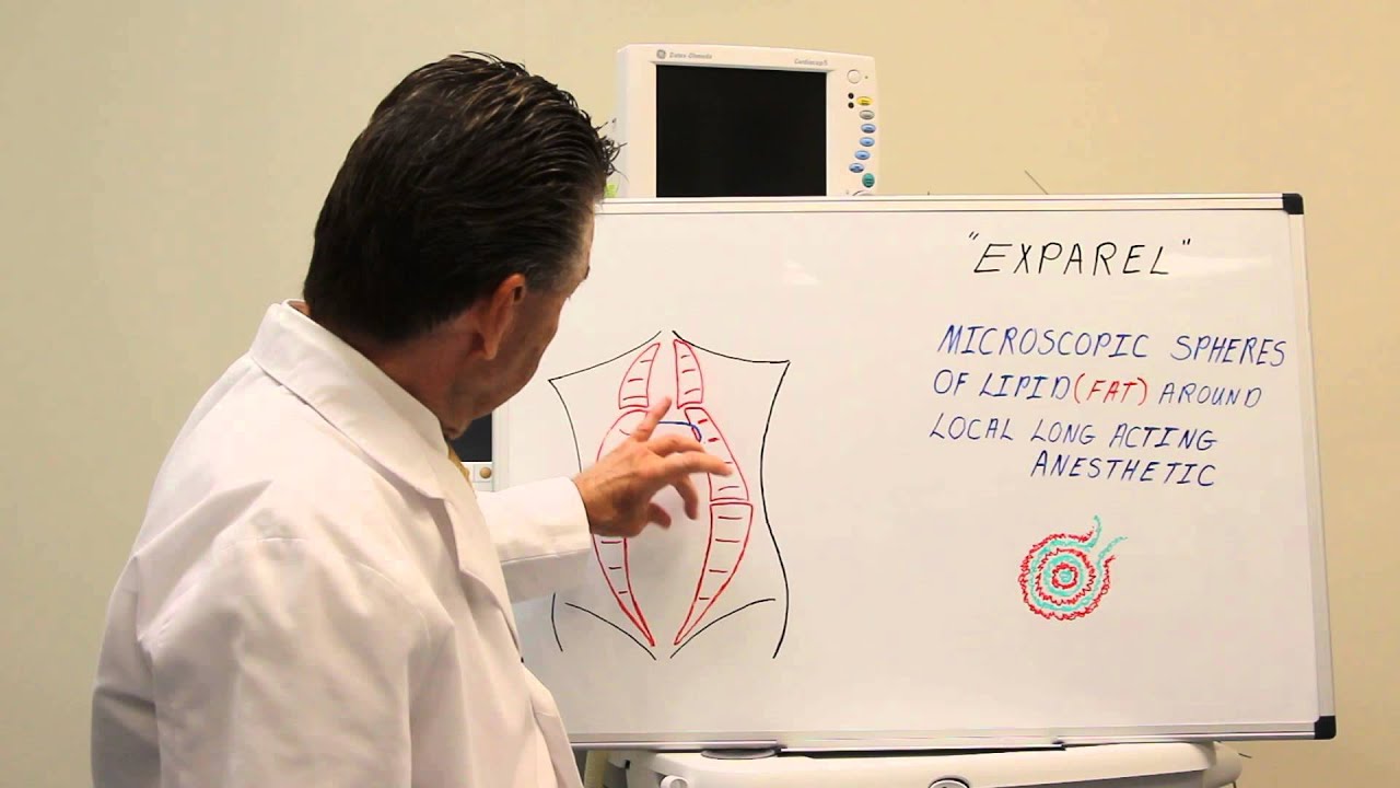 Exparel drug for time-released pain relief after surgery - YouTube