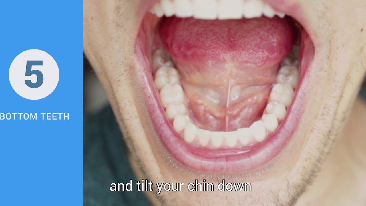 How to take pics of your teeth: Bottom teeth - YouTube