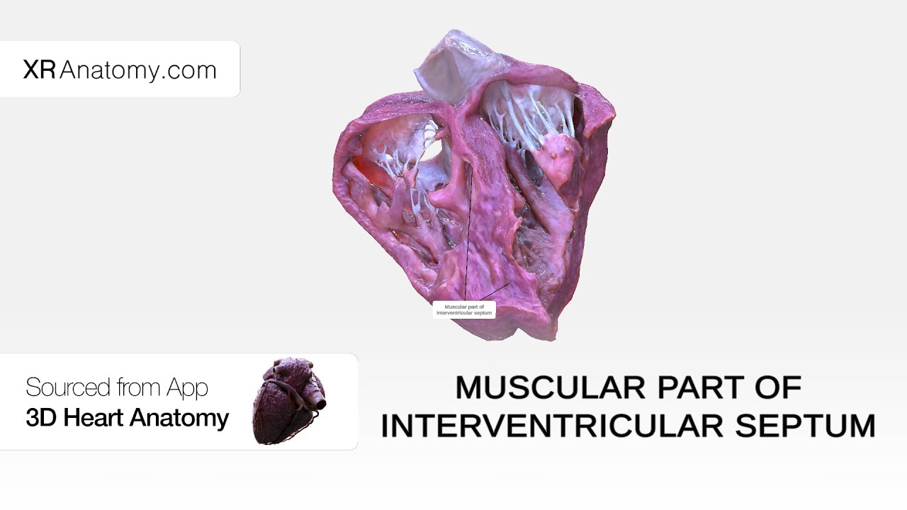Muscular part of interventricular septum - YouTube