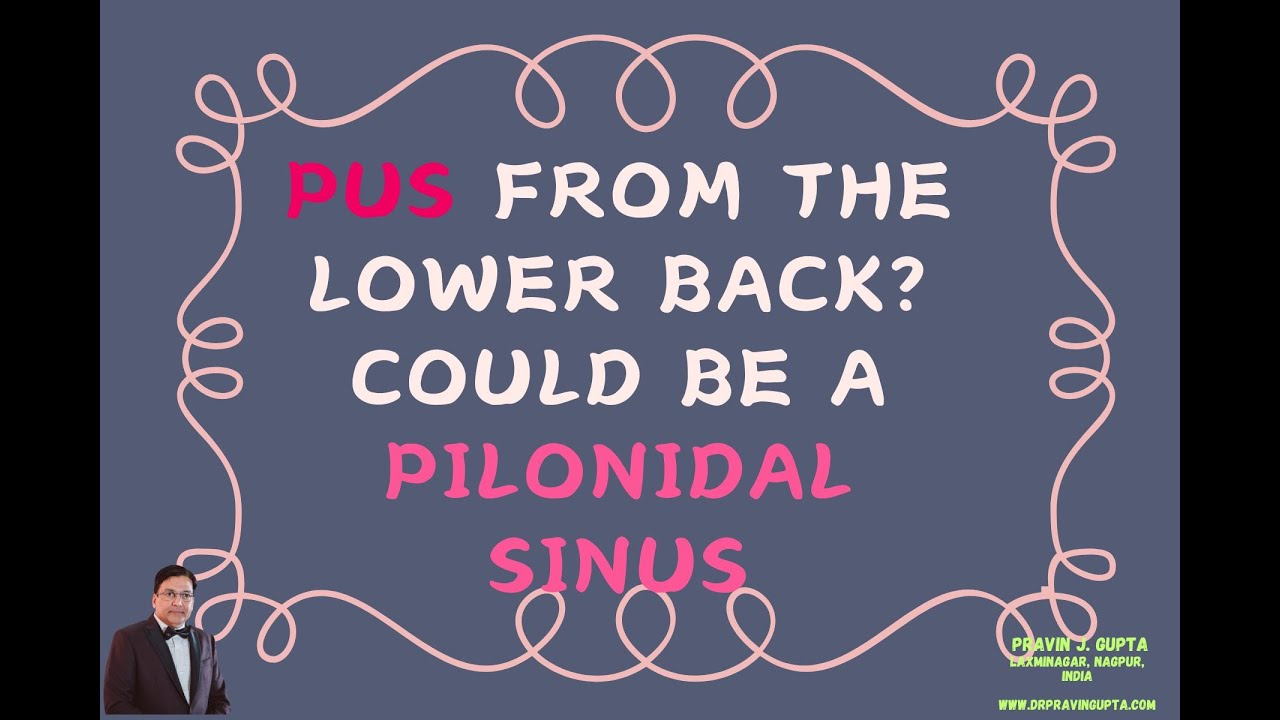 PUS DISCHARGE FROM THE LOWER BACK? COULD BE A PILONIDAL SINUS - YouTube