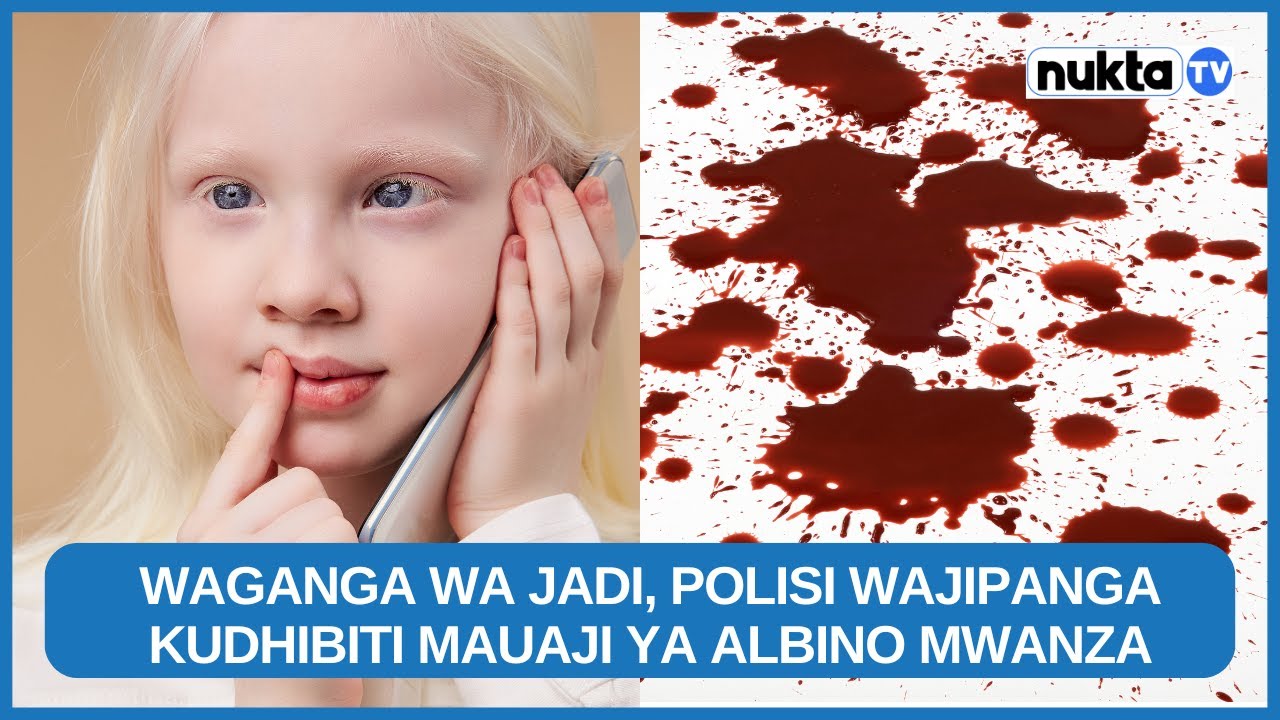 WAGANGA WA JADI, POLISI WAJIPANGA KUDHIBITI MAUAJI YA ALBINO MWANZA ...