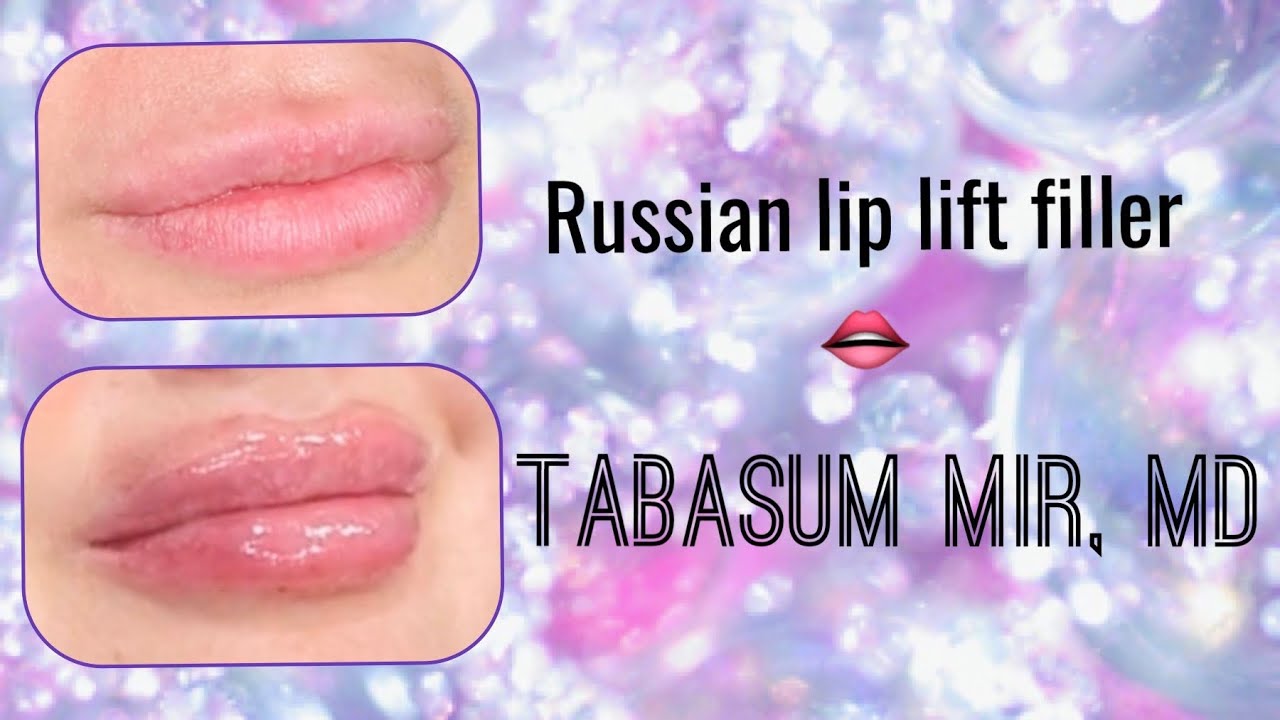The Russian Lip Filler Youtube