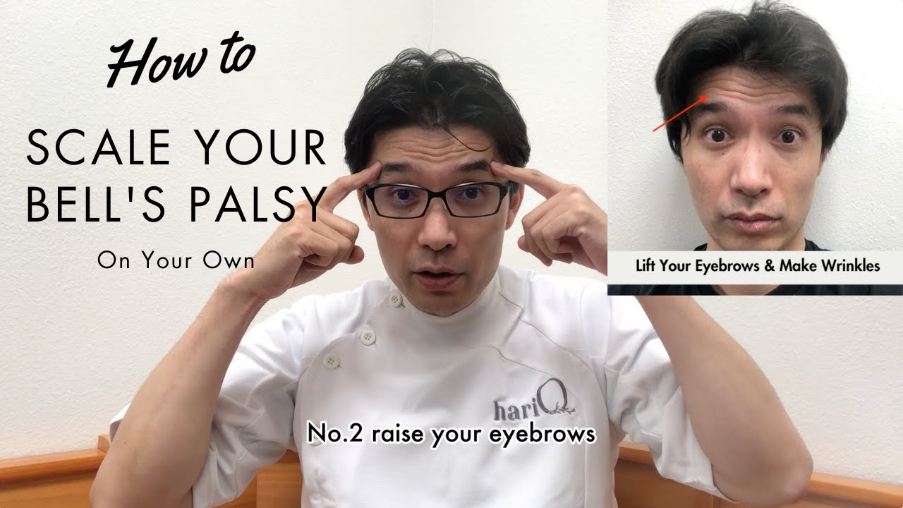 How to Scale Your Bell's Palsy on Your Own - YouTube