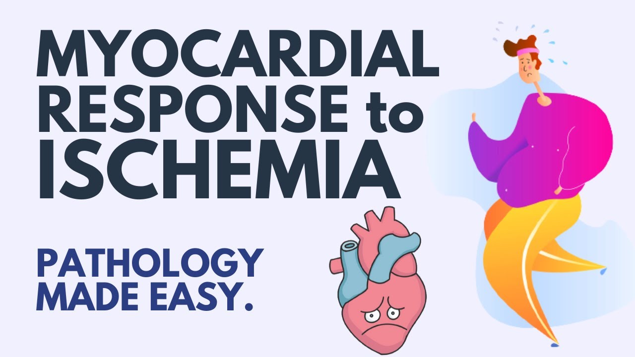 Myocardial Response to Ischemia l Pathology Made Easy - YouTube