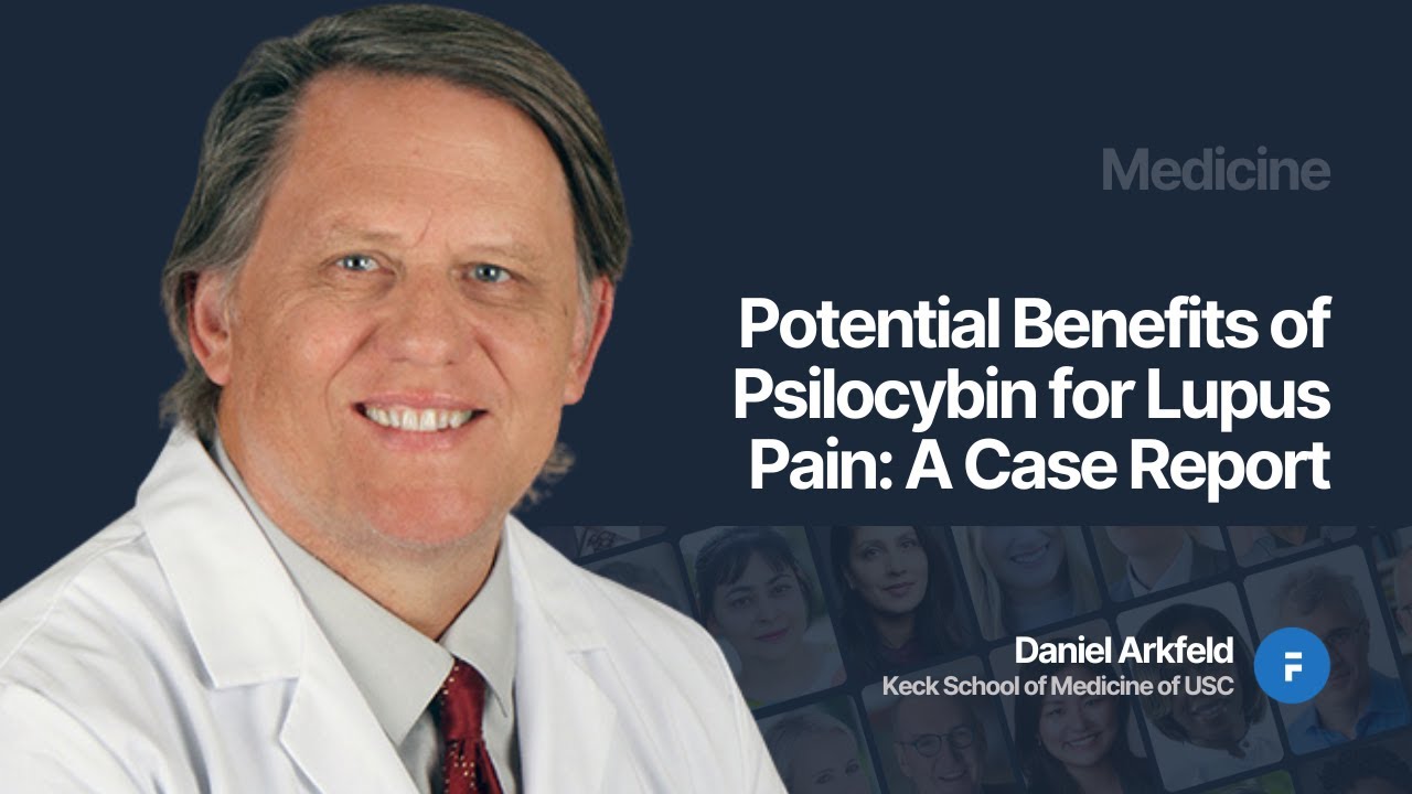 Potential Benefits of Psilocybin for Lupus Pain: A Case Report - Daniel ...