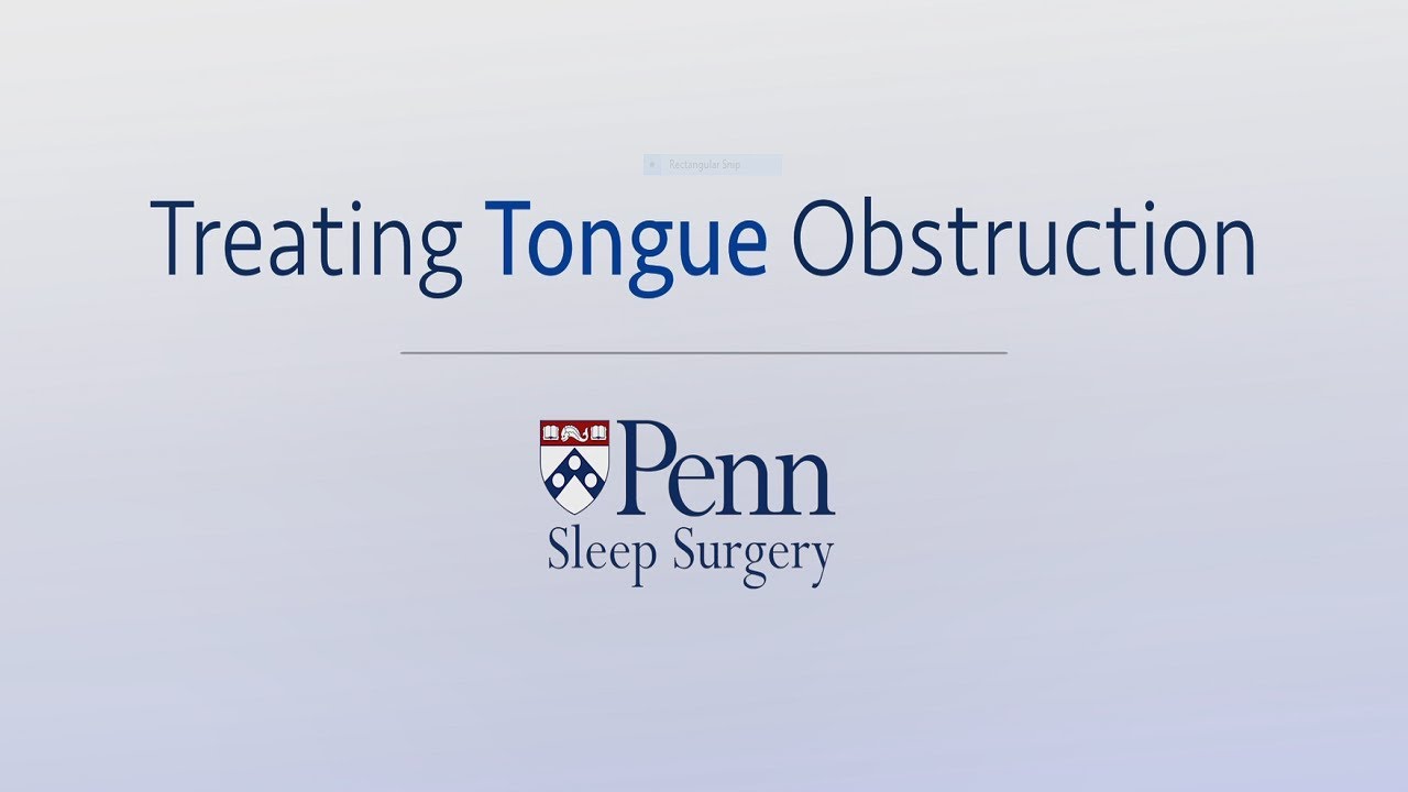 Treating Tongue Obstruction | Penn Sleep Surgery - YouTube