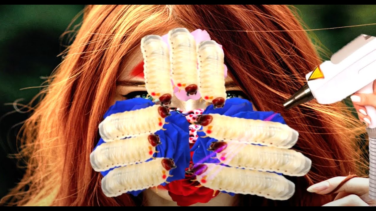 ASMR Healing Animation | Cleaning Addressing Girl's Face Infection ...