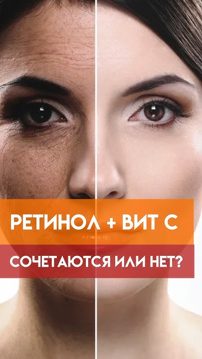 Ретинол и витамин С. Как правильно использовать? - YouTube