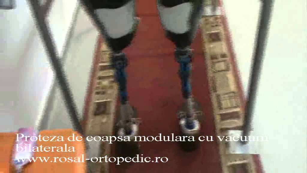 Proteza de coapsa bilaterala, proba de mers - Rosal Ortopedic - YouTube