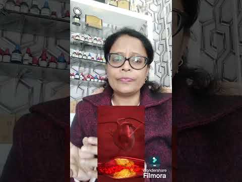 Is LDL Bad Cholesterol? 😨truth of LDL - YouTube