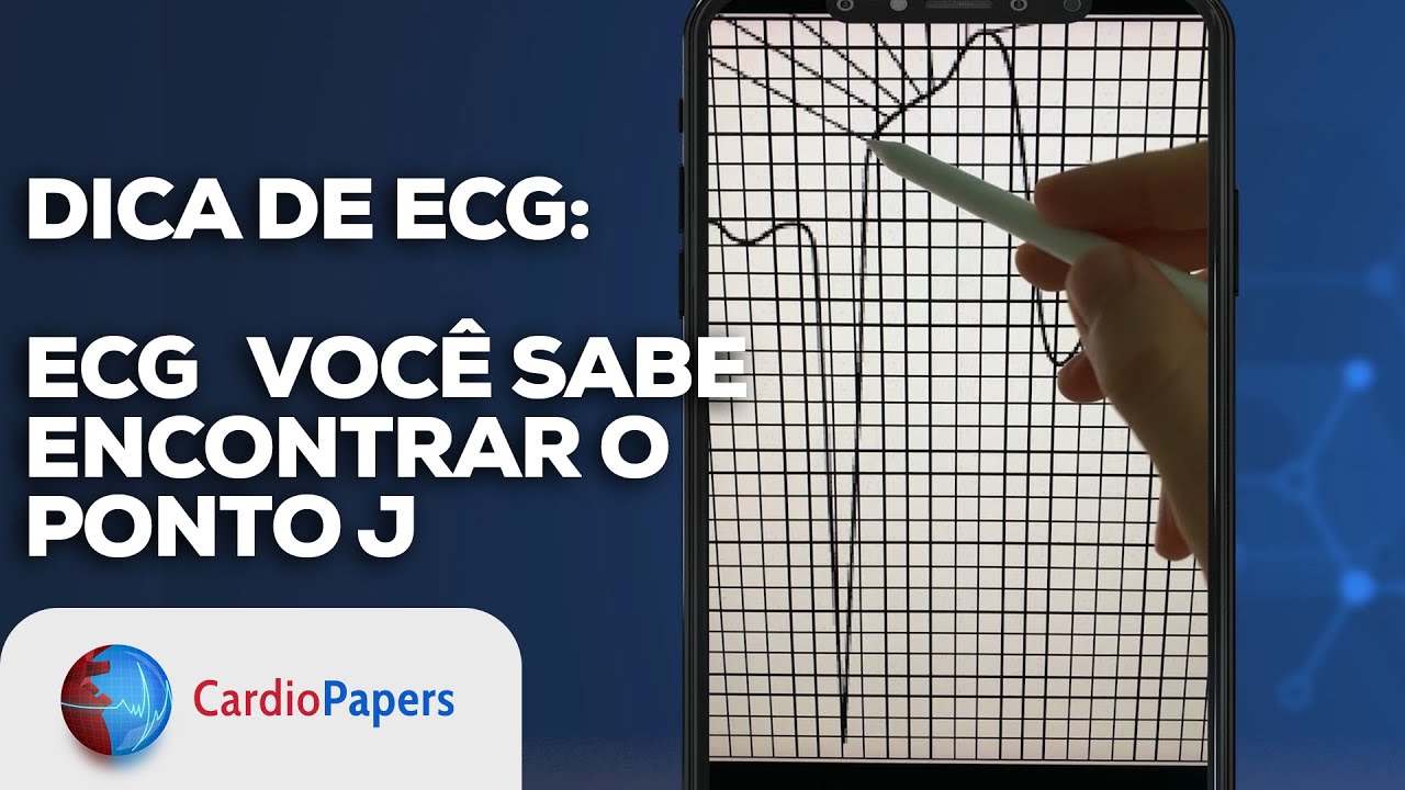 ECG você sabe encontrar o ponto J - YouTube