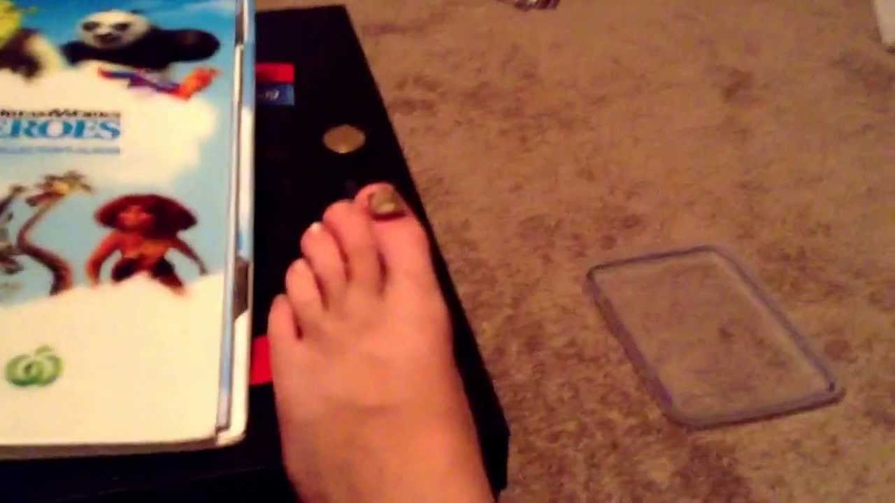 1 of the worst toe's in the world - YouTube