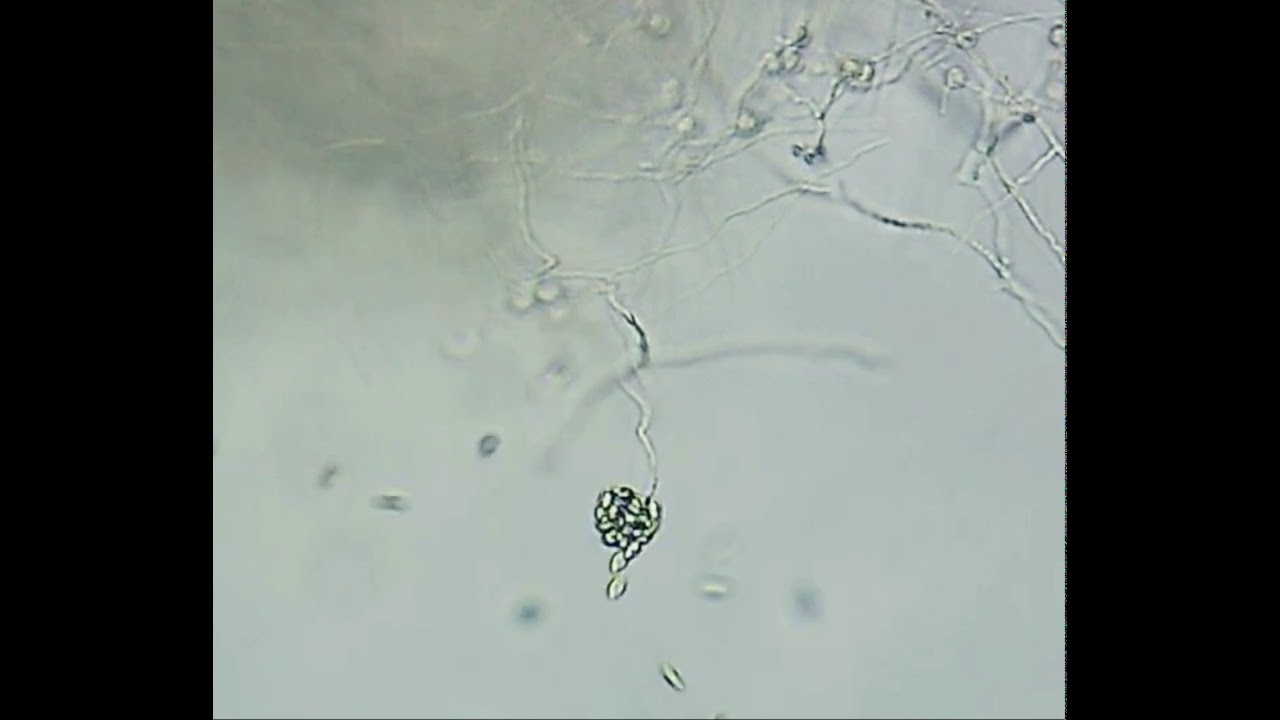 Release of Zoospores by Pythium sp. - YouTube
