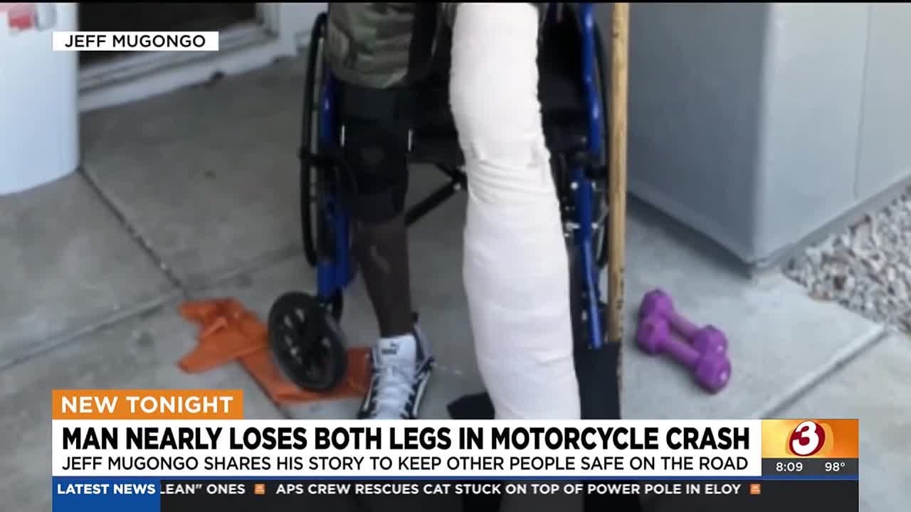 Man highlights motorcycle safety after nearly losing legs in crash ...