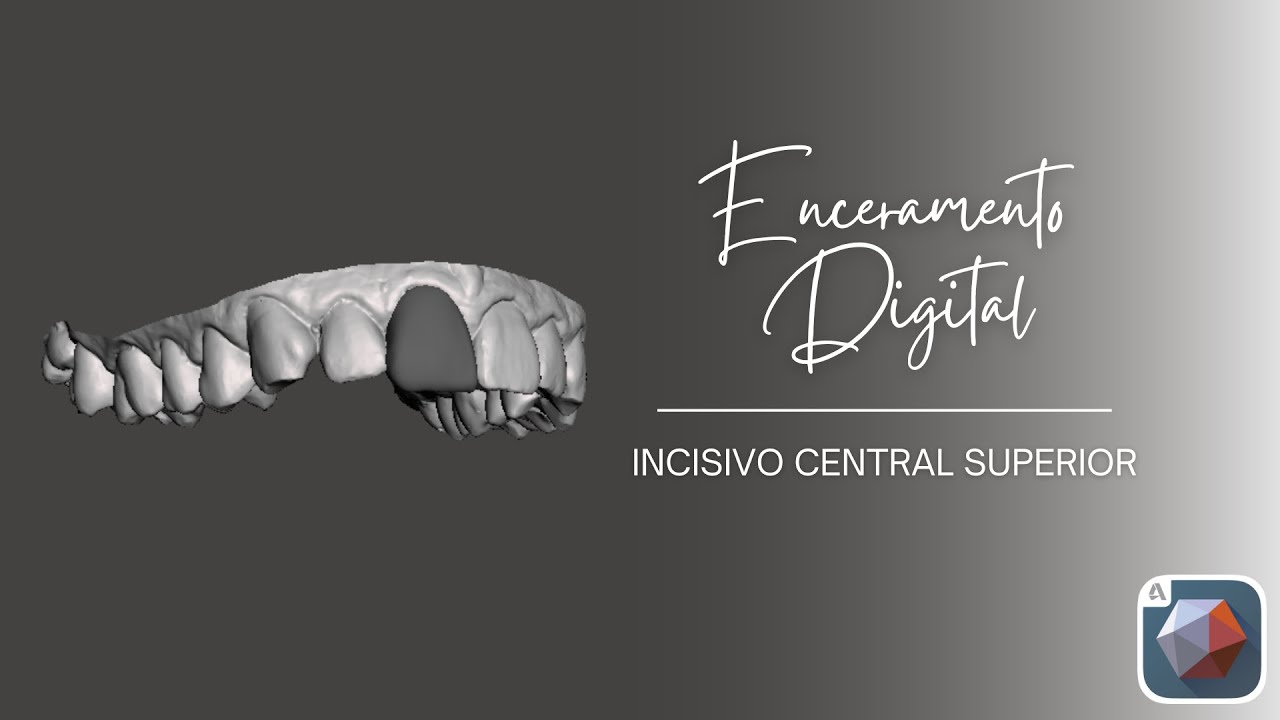 Meshmixer - Recorte de Modelo e Enceramento Digital do Dente 11 - YouTube