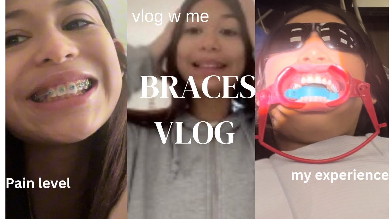 Come with me to get my braces !/ vlog - YouTube