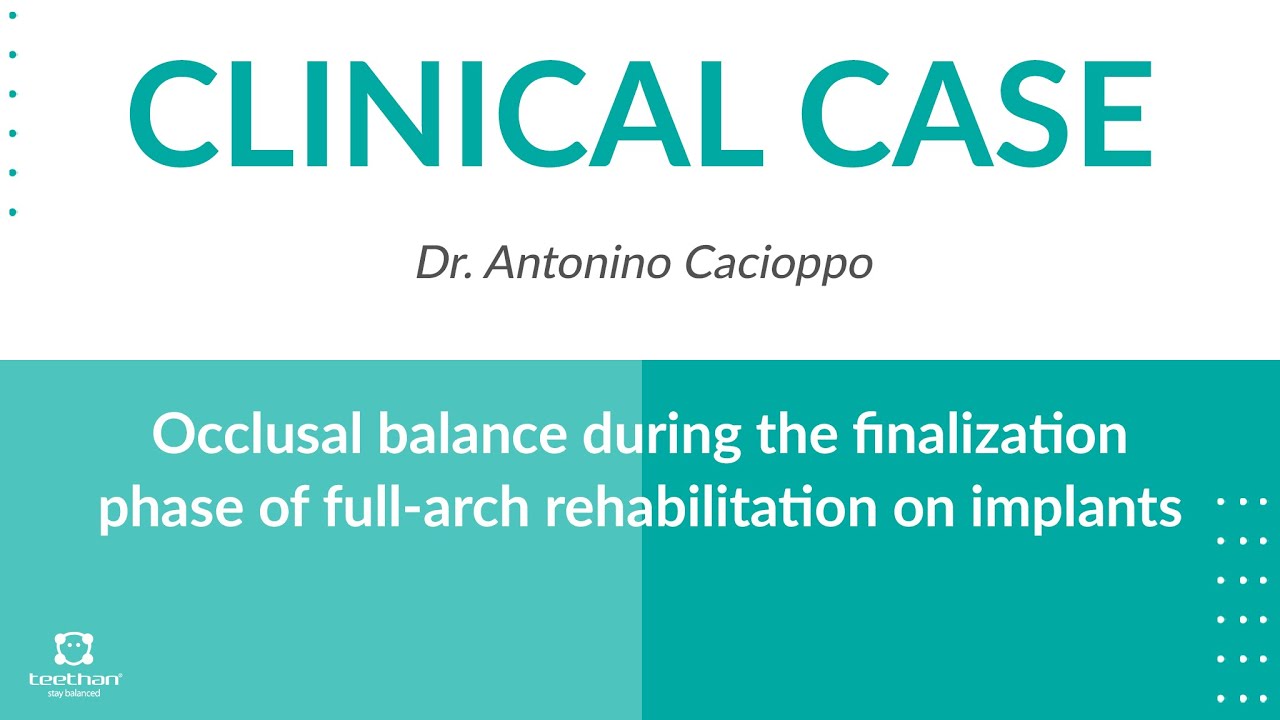 CLINICAL CASE Occlusal balance during the finalization phase of full ...