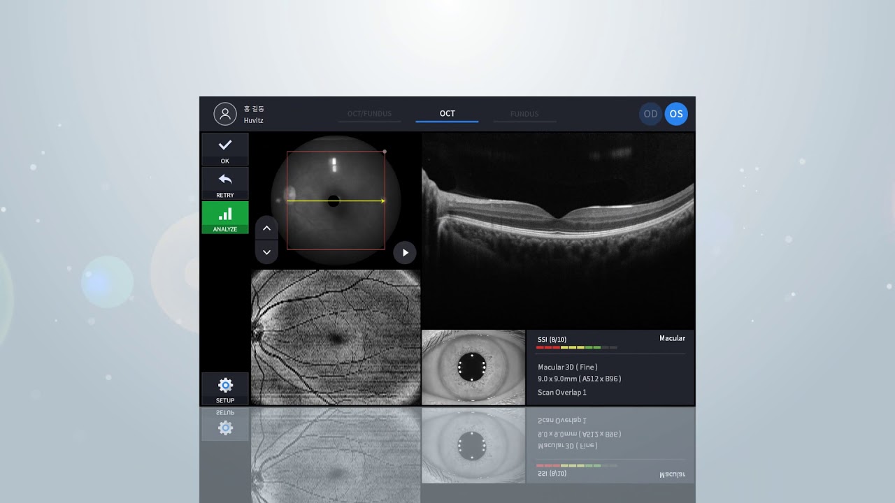 Huvitz OCT (All-in-One OCT with Fundus Camera) - YouTube