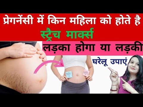 Pregnancy me kyu hote hai scratch marks || Gender prediction by scratch ...