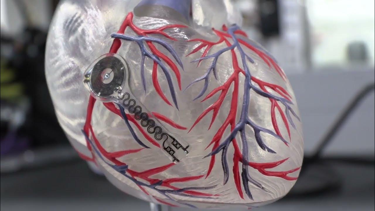 Smart, Dissolving Pacemaker Communicates With Body-Area Sensor and ...