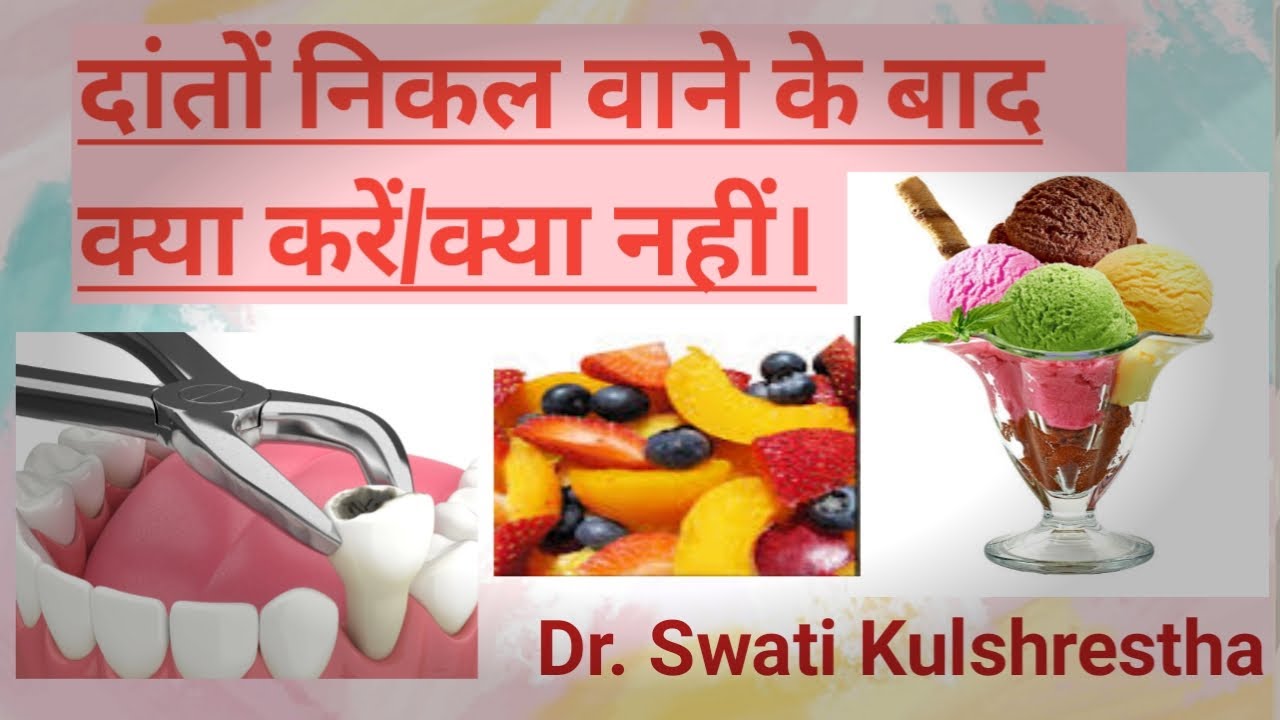 दांत निकलवाने के बाद क्या करें?post extraction instructions - YouTube
