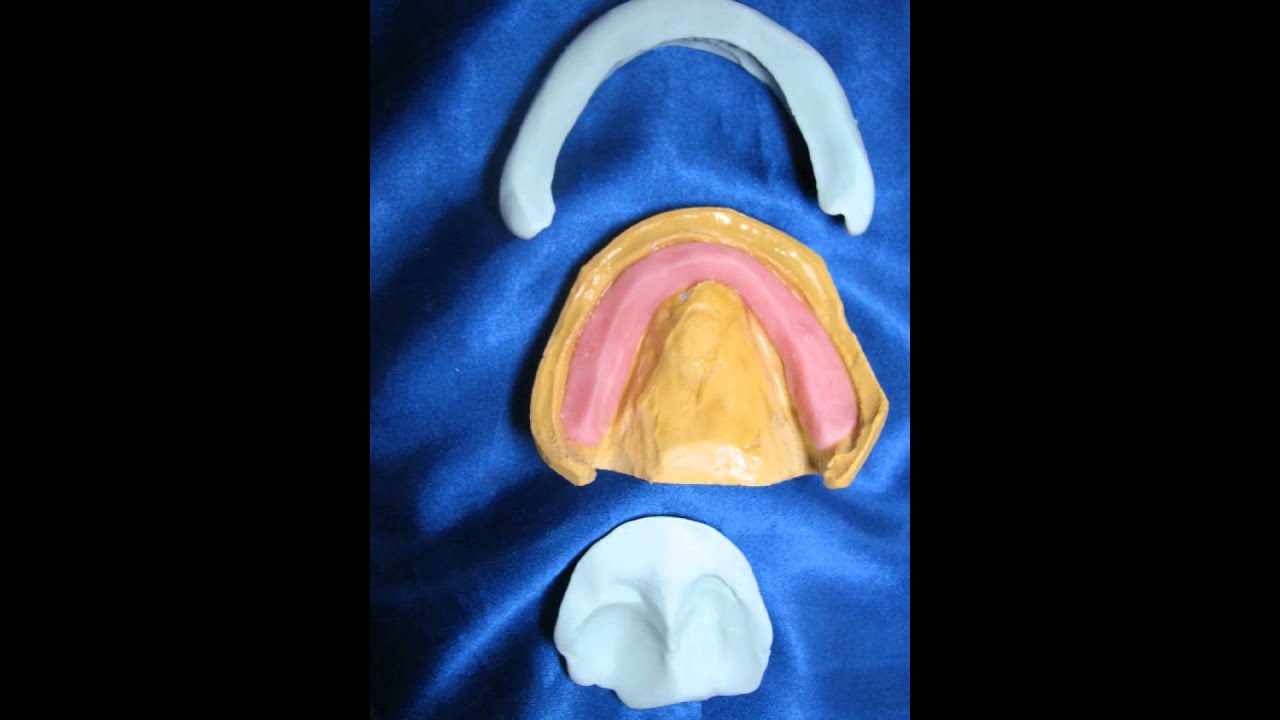 Duplicado de Zona Neutra www.drsergioarmas.com Dr Sergio Armas - YouTube