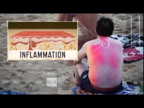 The Effects Of Sunlight On Our Skin - YouTube
