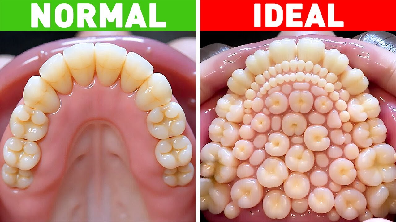 Here’s What Your TEETH Should REALLY LOOK Like - YouTube