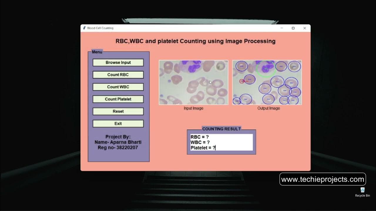 Blood Cell Classification using Image Processing | Blood Cell Detection ...