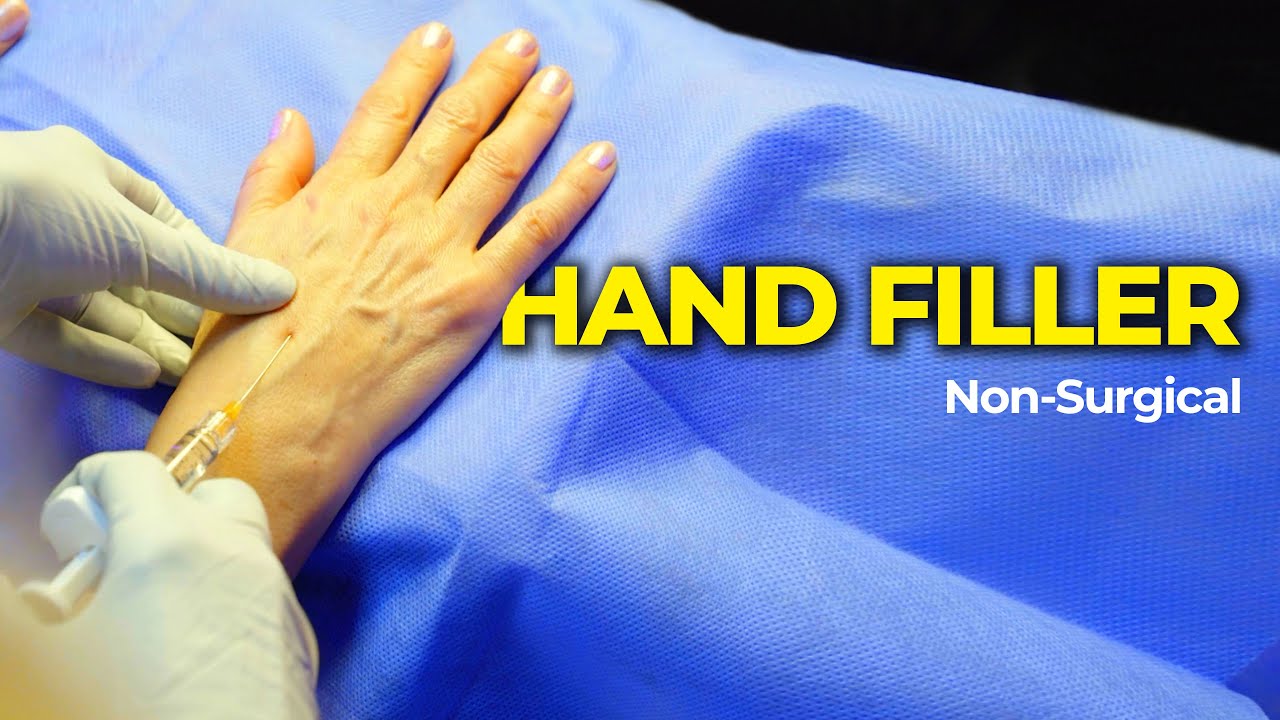 Hand Filler: Achieve Youthful and Smooth Hands! - YouTube