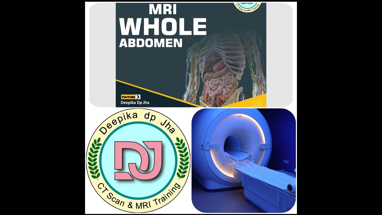 MRI whole abdomen planning and positioning in Philips 3T - YouTube