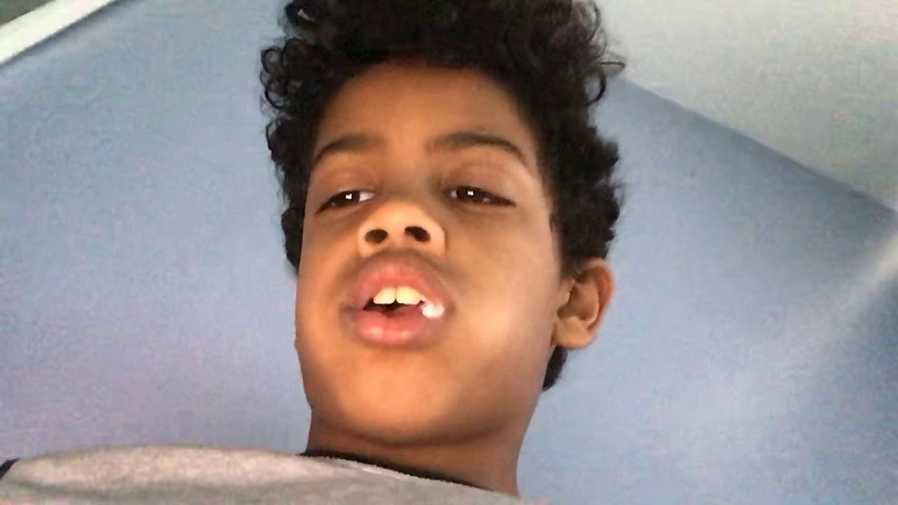 Winston teeth out 🦷🦷🦷🦷🦷🦷🦷🦷🦷🦷🦷👣🦯 - YouTube