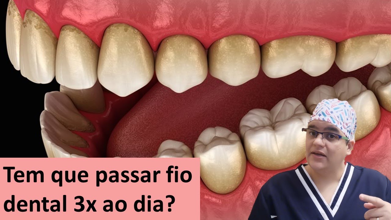Com doença de gengiva tem que escovar e passar fio 3x ao dia?| Dra ...
