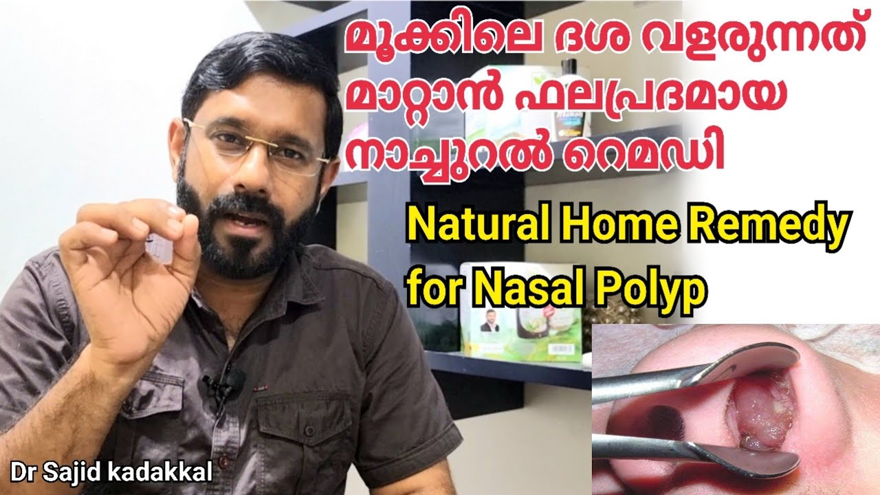 Natural Home Remedy for Nasal Polyp, മൂക്കിലെ ദശ വളരുന്നതിന് ഫലപ്രദമായ ...