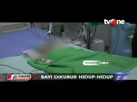 Kondisi Bayi Dian yang Dikubur Hidup-hidup Oleh Ibunya Kian Memburuk