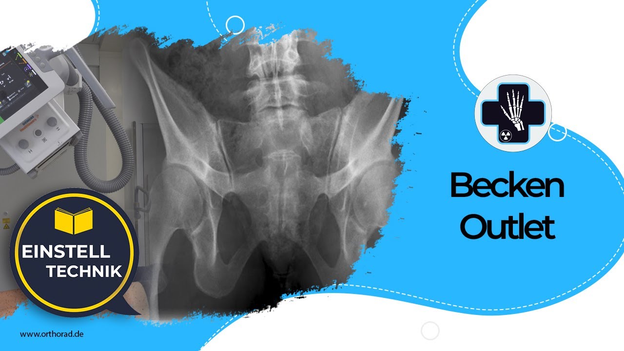 Röntgen Becken Outlet - YouTube