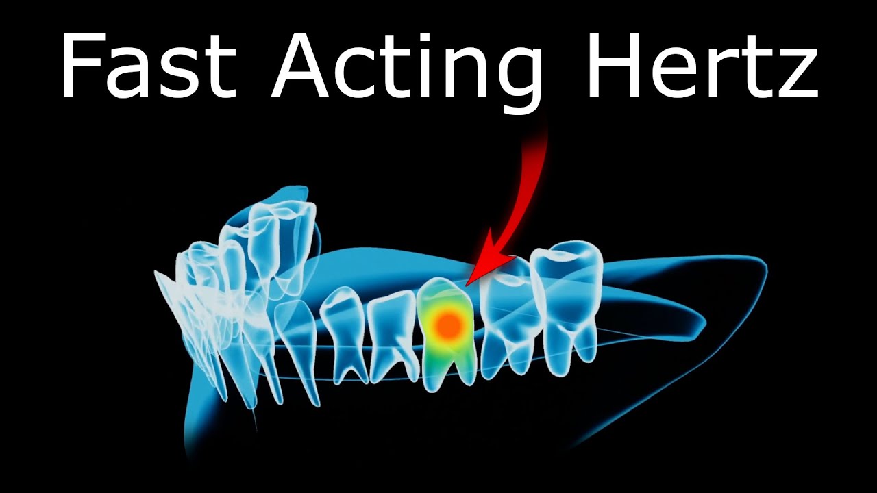 Toothache MIRACLE Painkiller Audio Frequency Immediate Deep Relief ...