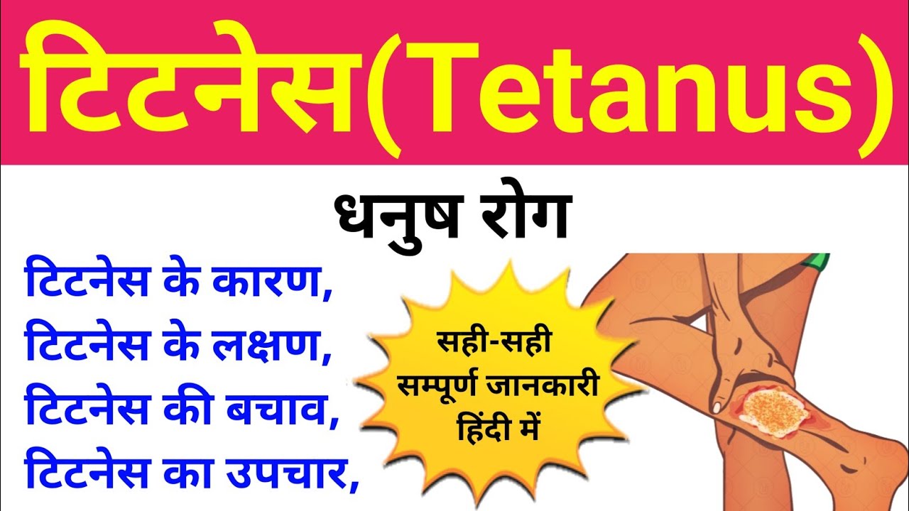 टिटनेस | tetanus disease | tetanus injection | tetanus symptoms ...