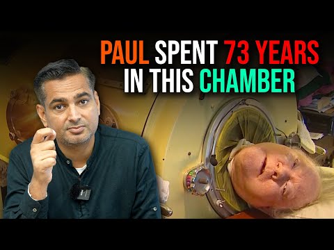 Paul spent his 73 years in Iron Lung!