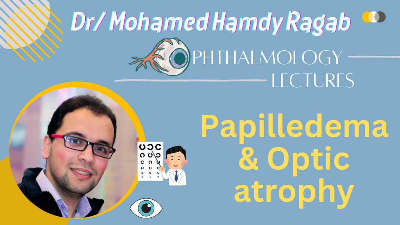 Neuro 3: Papilledema & Optic atrophy - YouTube