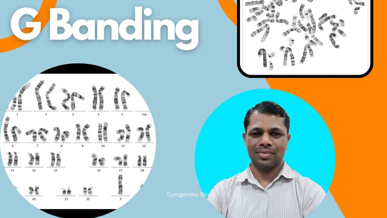 GTG banding mechanism & procedure #G banding #Giemsa banding - YouTube